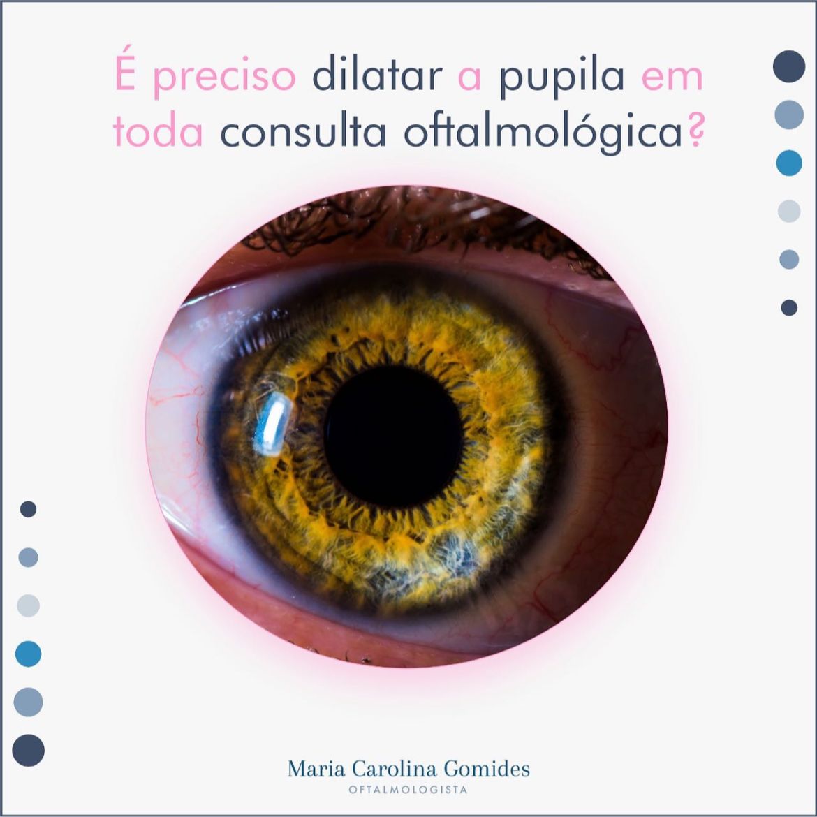 Dilatar pupila em toda consulta? – Dra. Carolina Gomides ...
