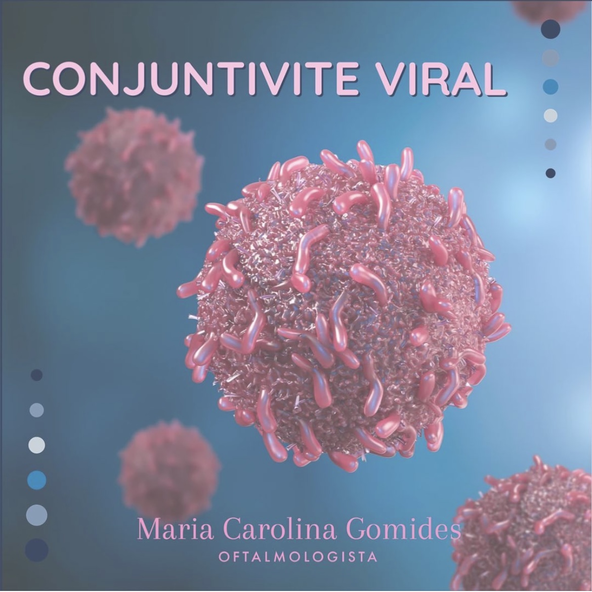 Conjuntivite Viral – Dra. Carolina Gomides – Oftalmologista São Paulo – SP